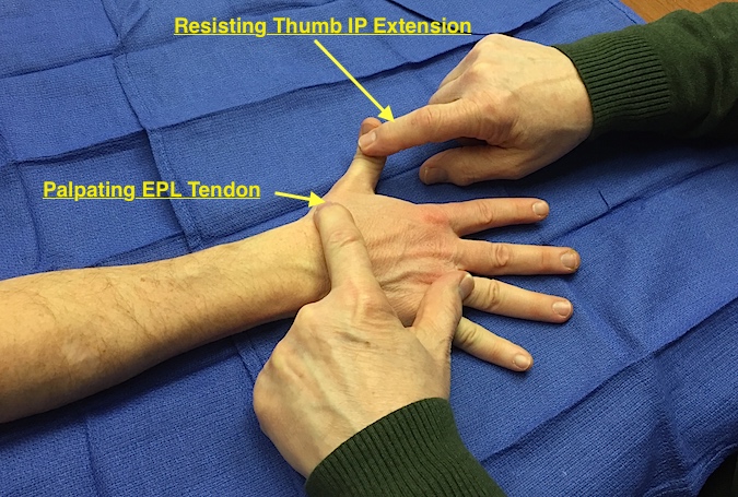 Extensor Pollicis Longus (EPL) Exam | Anatomic Structures at Risk