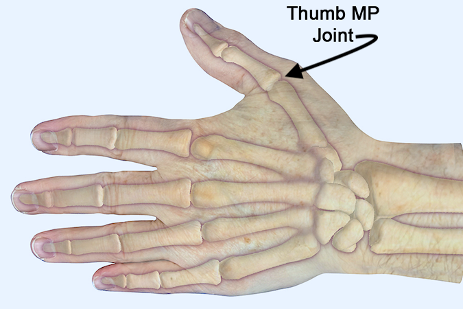 Thumb MP Joint Exam | Anatomic Structures at Risk