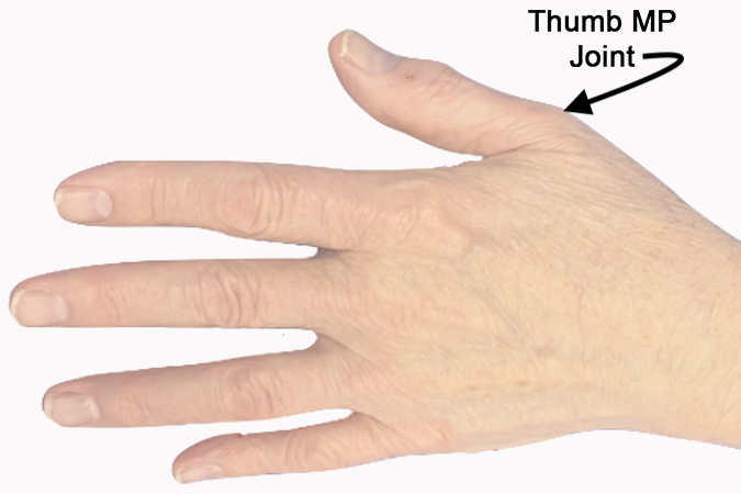 Thumb MP Joint Exam | Anatomic Structures at Risk