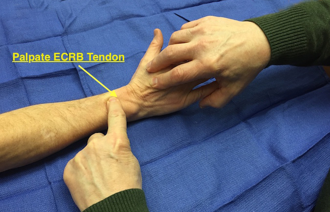 Extensor Carpi Radialis Brevis Exam | Anatomic Structures at Risk