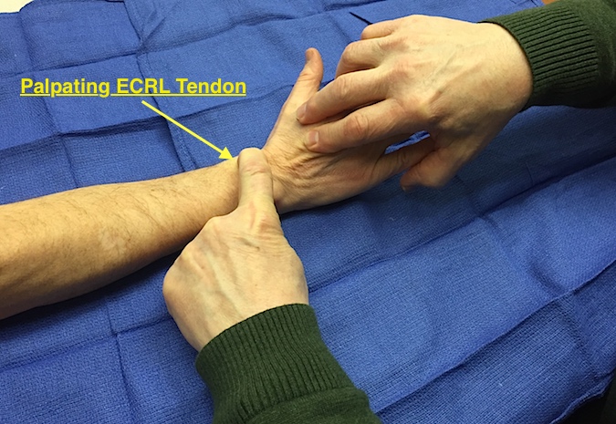 Extensor Carpi Radialis Longus Exam | Anatomic Structures at Risk