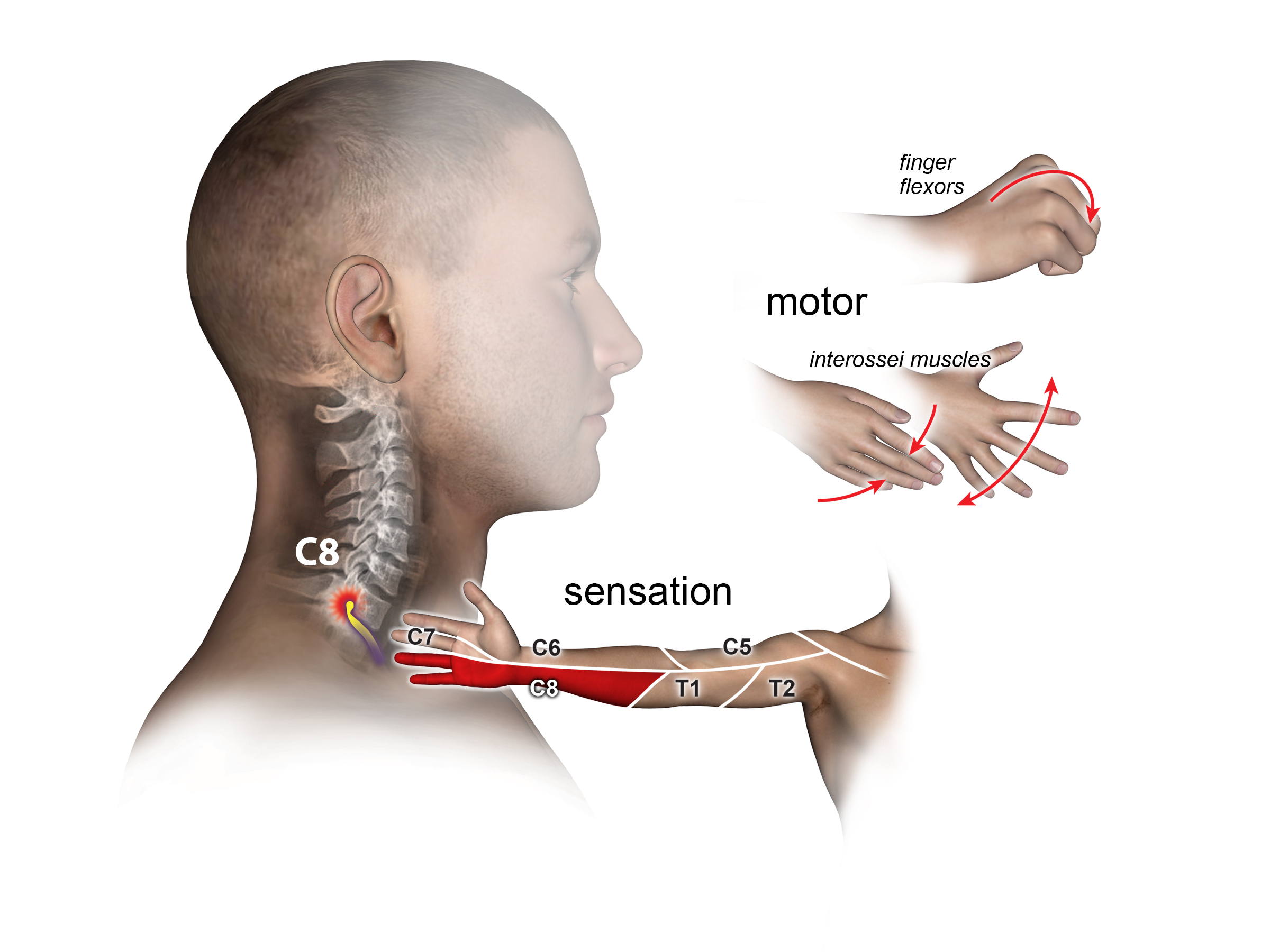 Common Digital Nerves in Second, Third and Fourth Webs Exam | Anatomic ...