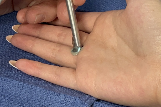 Common Digital Arteries in Second, Third and Fourth Webs and Vein Exam ...